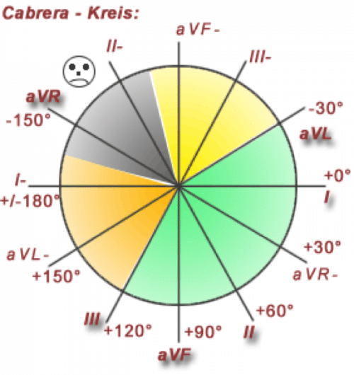 EKG: Bestäm Elaxel - Kardiologi.se