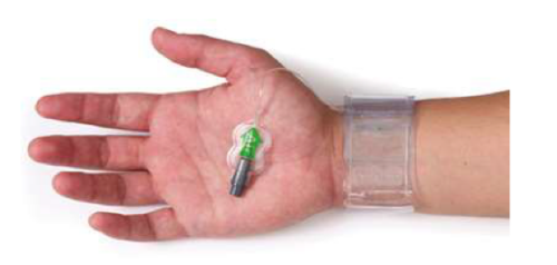 TR-band efter koronarangiografi via a. radialis - Kardiologi.se