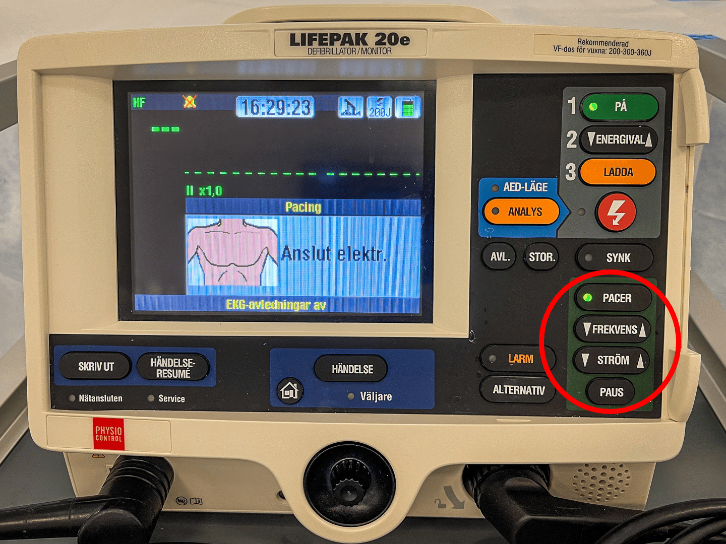 Temporär Pacemaker (transkutan, transvenös) - Kardiologi.se