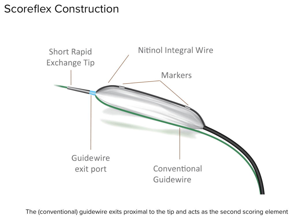 PCI-behandling av förkalkade kranskärl: teknik, tips och evidens ...